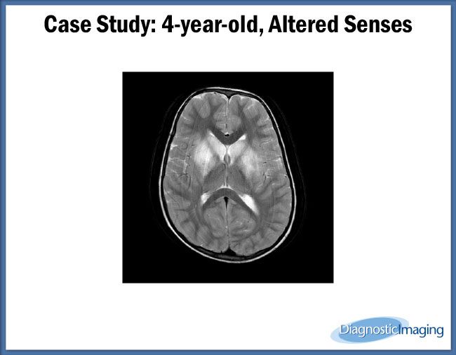 4-year-old, Altered Senses