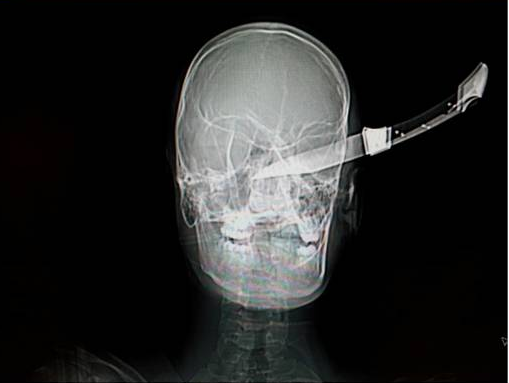 What’s Your Strangest Imaging Case?