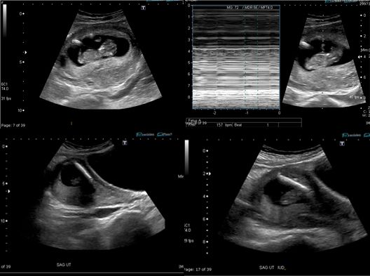 What's the Strangest Imaging Case?