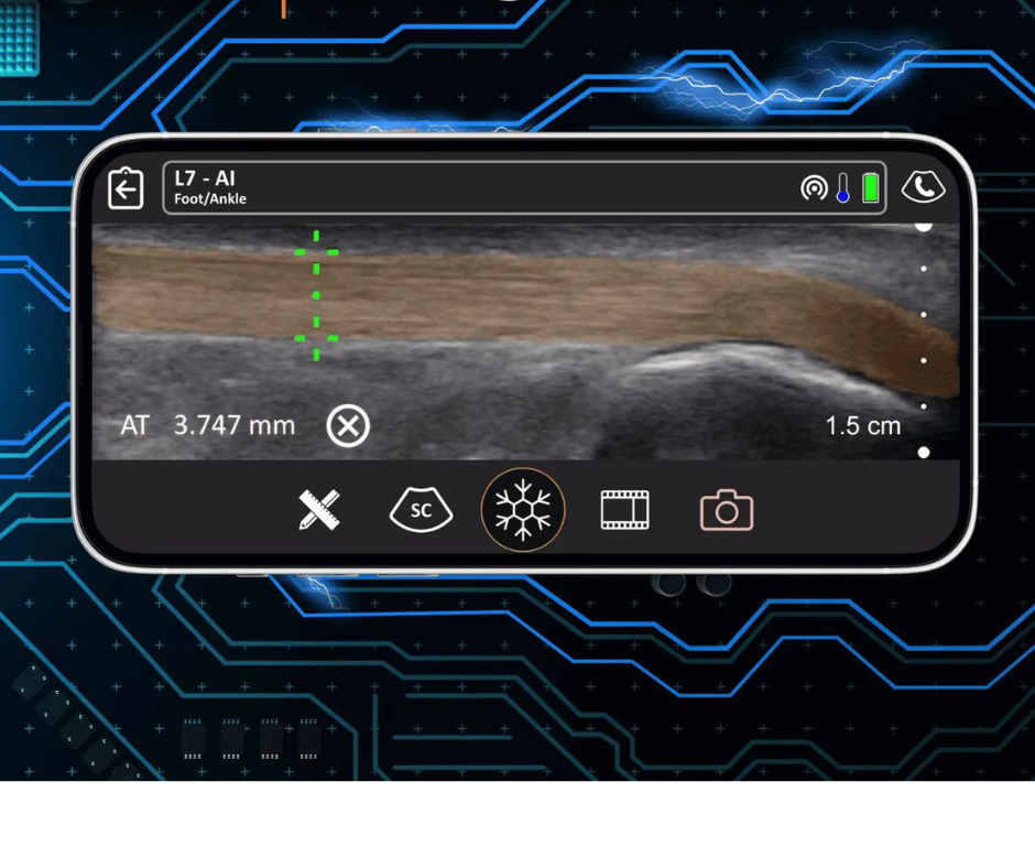 Clarius Mobile Health Gets FDA Nod for AI Ultrasound Musculoskeletal ...