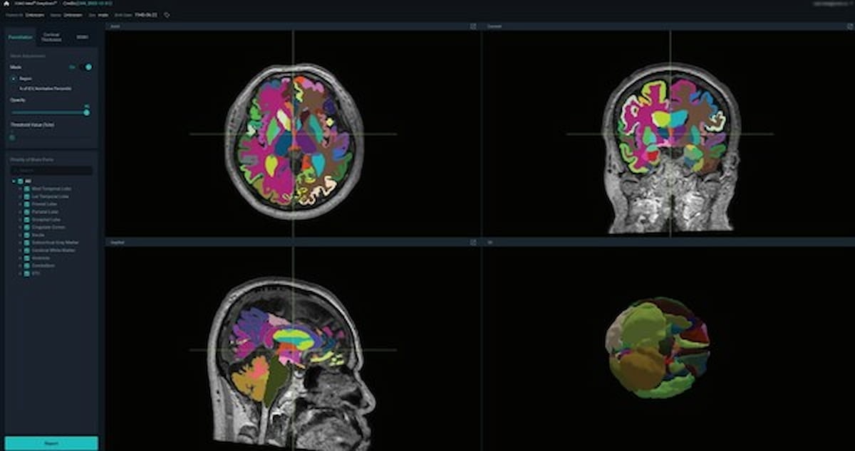 FDA Clears Emerging AI Software for Brain MRI FDA Clears Emerging AI Software for Brain MRI