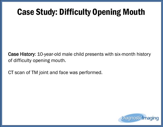 Difficulty Opening Mouth