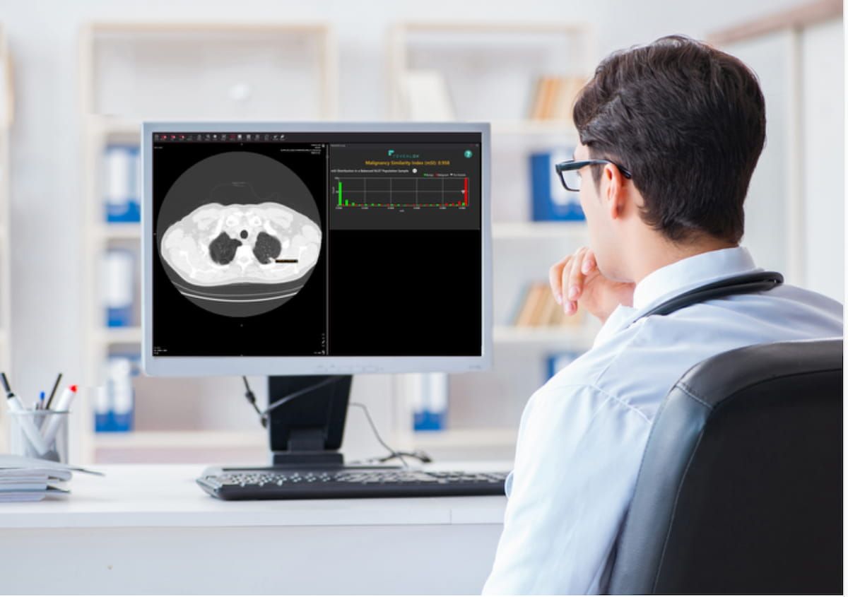 FDA Clears AI-Powered Software for Assessment of Incidental Lung ...