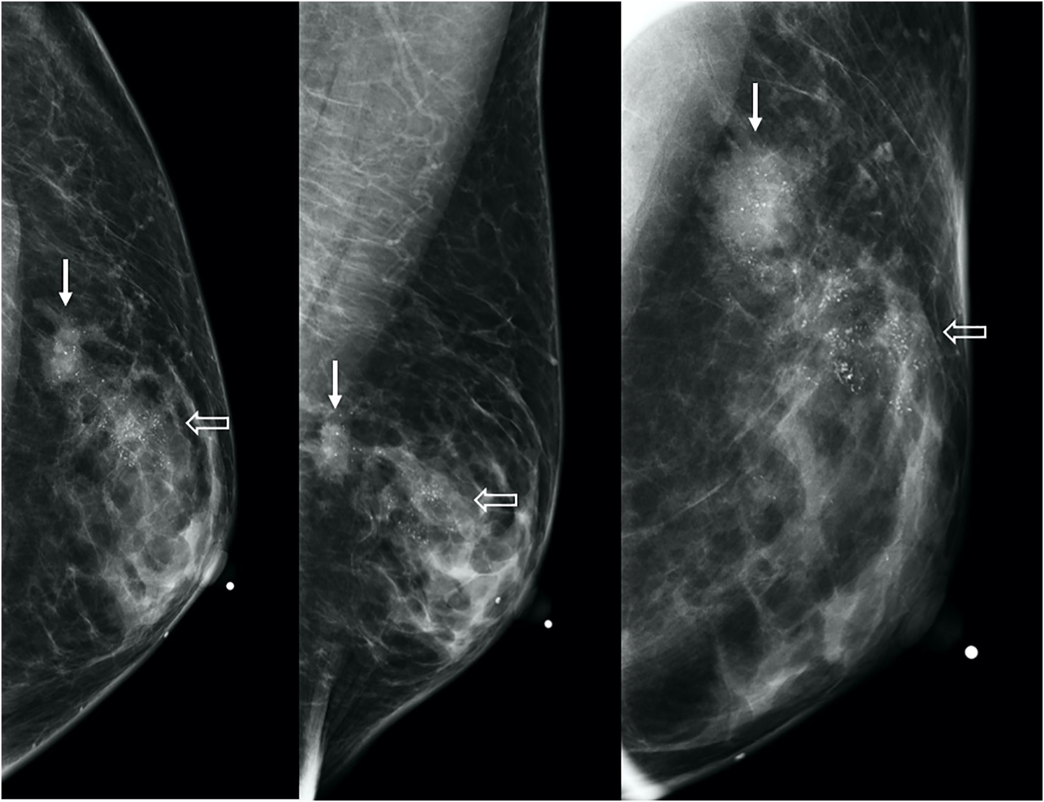 Understanding Breast Imaging Features of Transgender Women Is Key to ...