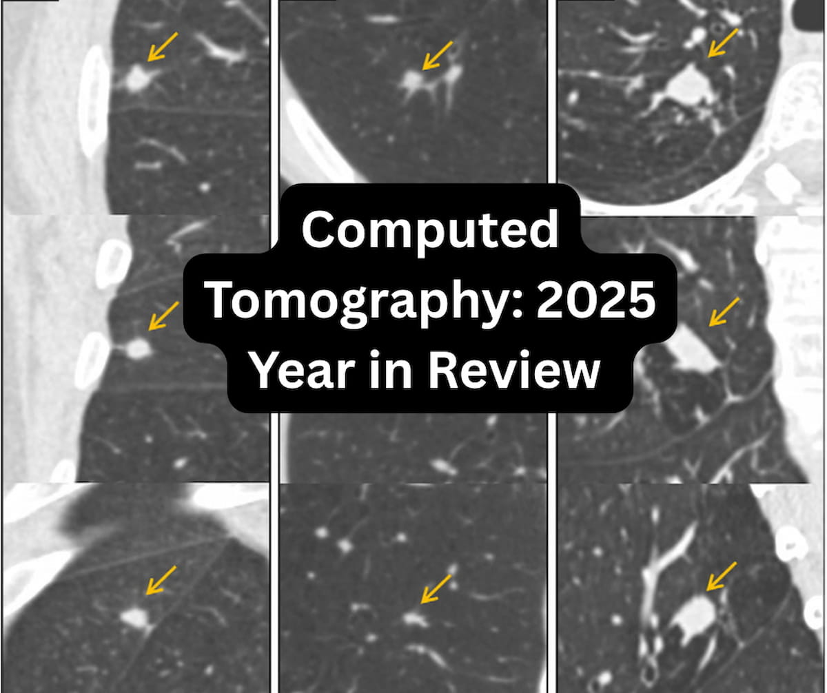 Computed Tomography: 2025 Year in Review | Diagnostic Imaging