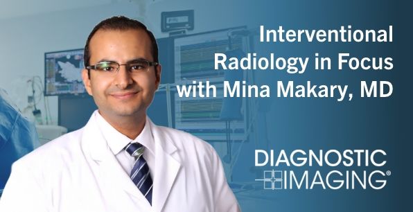 Interventional Radiology in Focus: Current Perspectives on Genicular ...