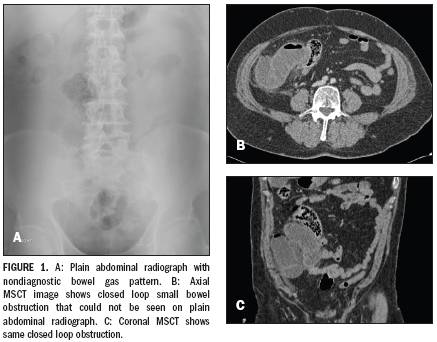 Patient-specific approach assists in acute abdomen | Diagnostic Imaging