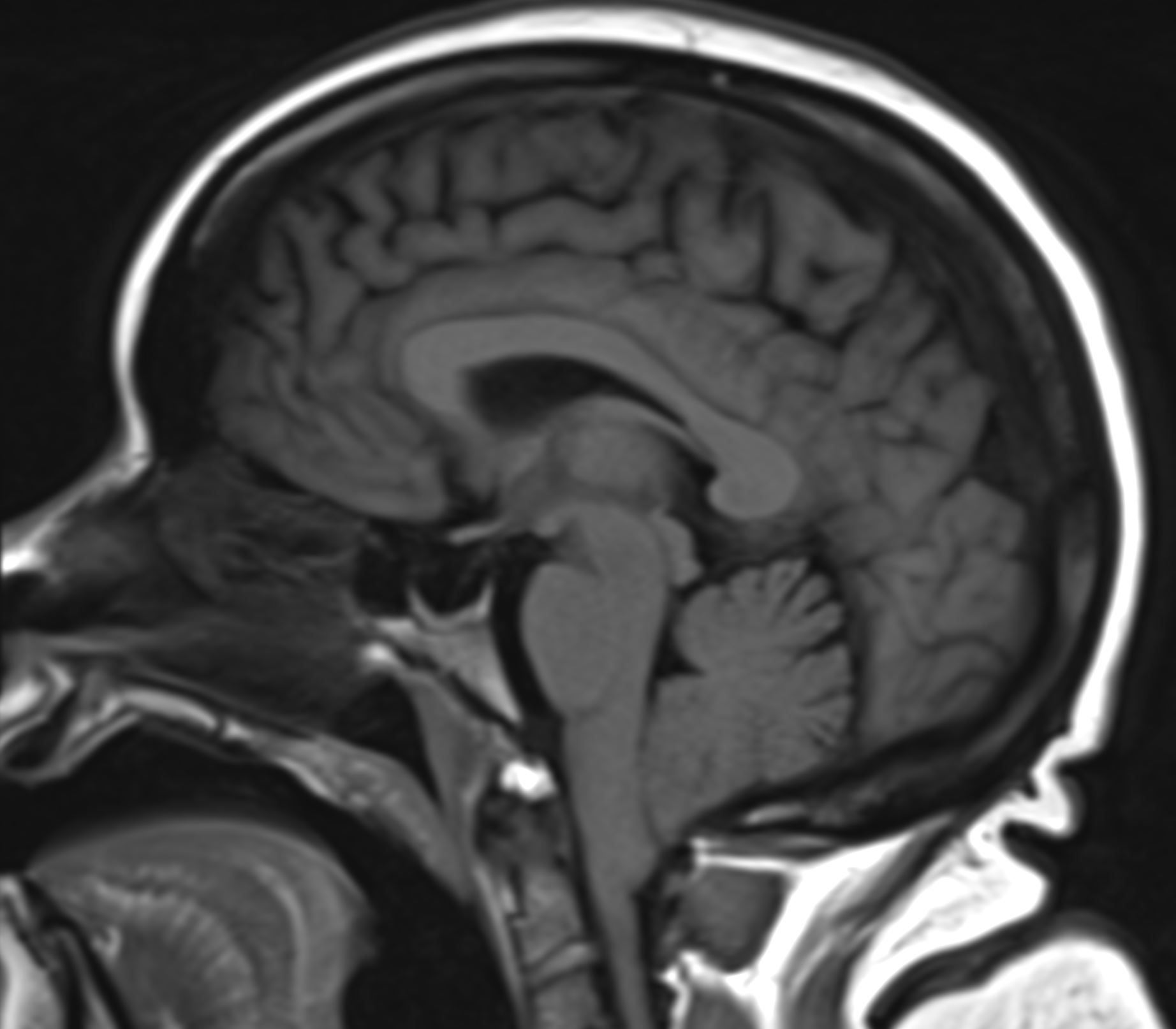 Image IQ: 52 y/o with Vertigo, Headache, Tinnitus | Diagnostic Imaging