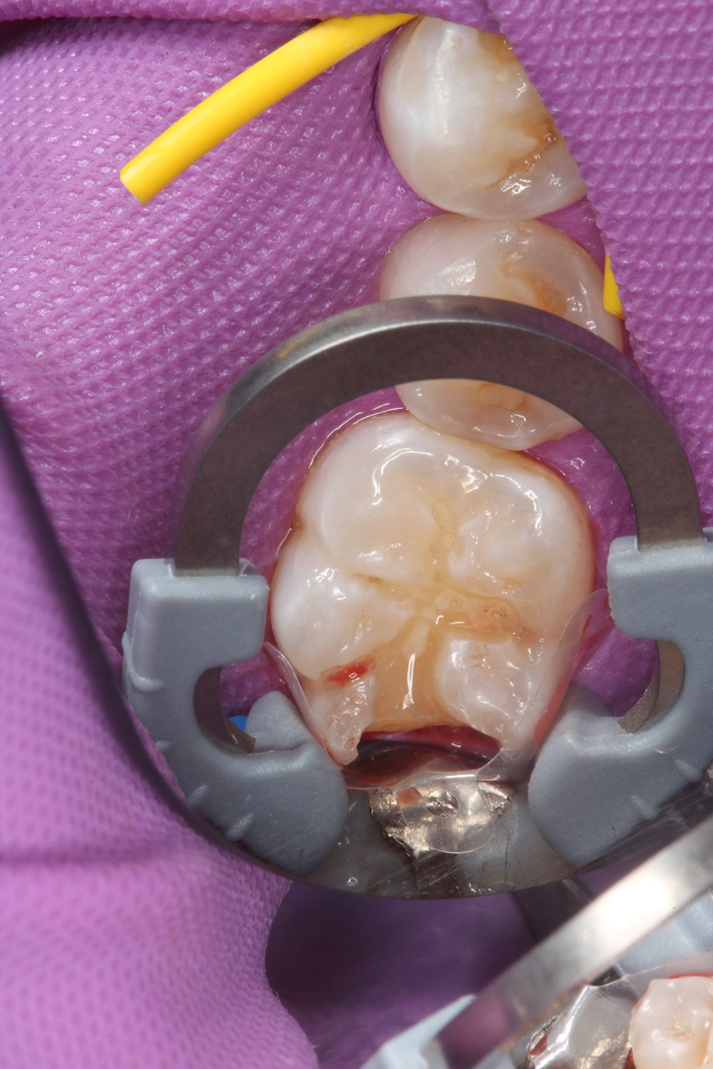 Deep Dive: A Sectional Matrix System That’s Predictable, Efficient