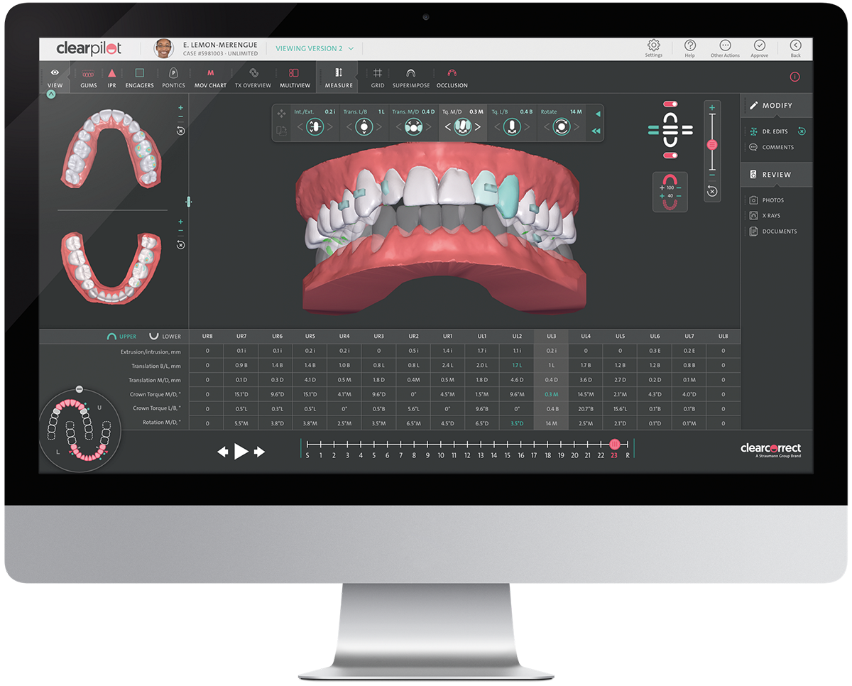 Bellus3D announces Dental Pro 3D face scanning app