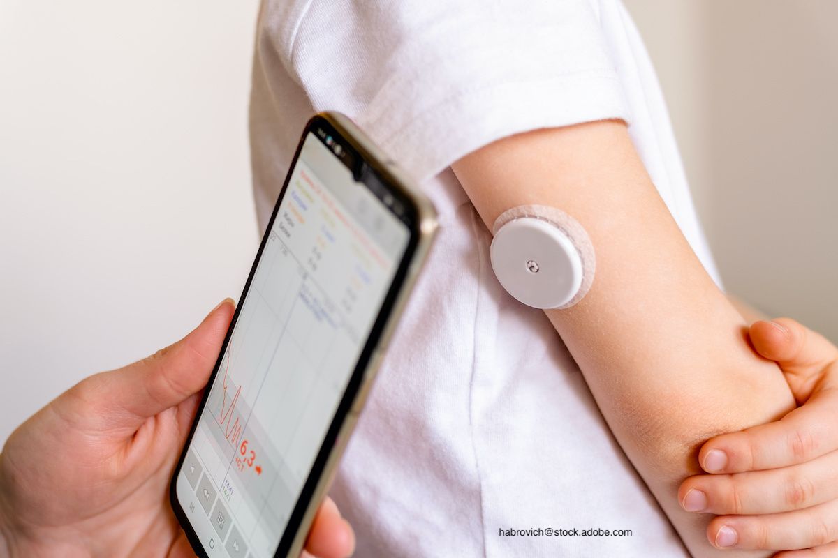 Improving Glycemic Markers in Children with Type 1 Diabetes Using ...