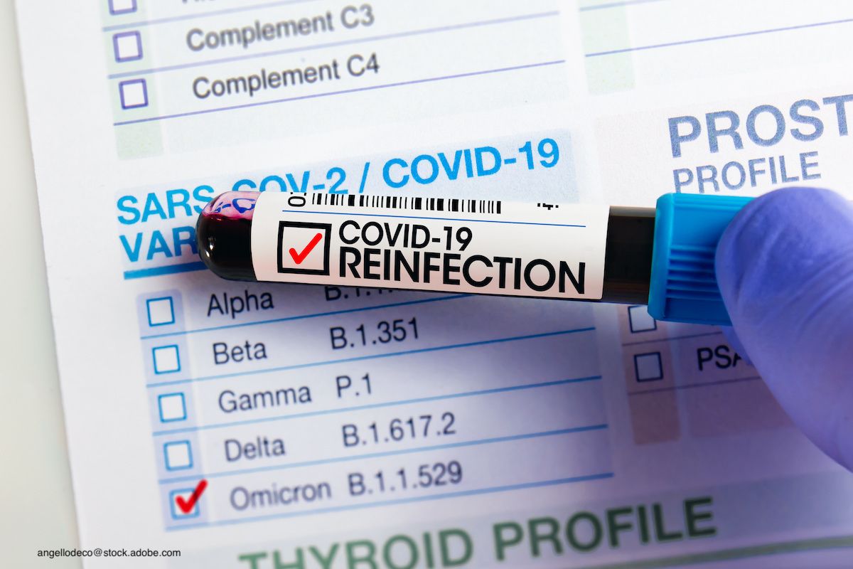 COVID-19 Reinfection Could Carry More Risks Than Initial Infection