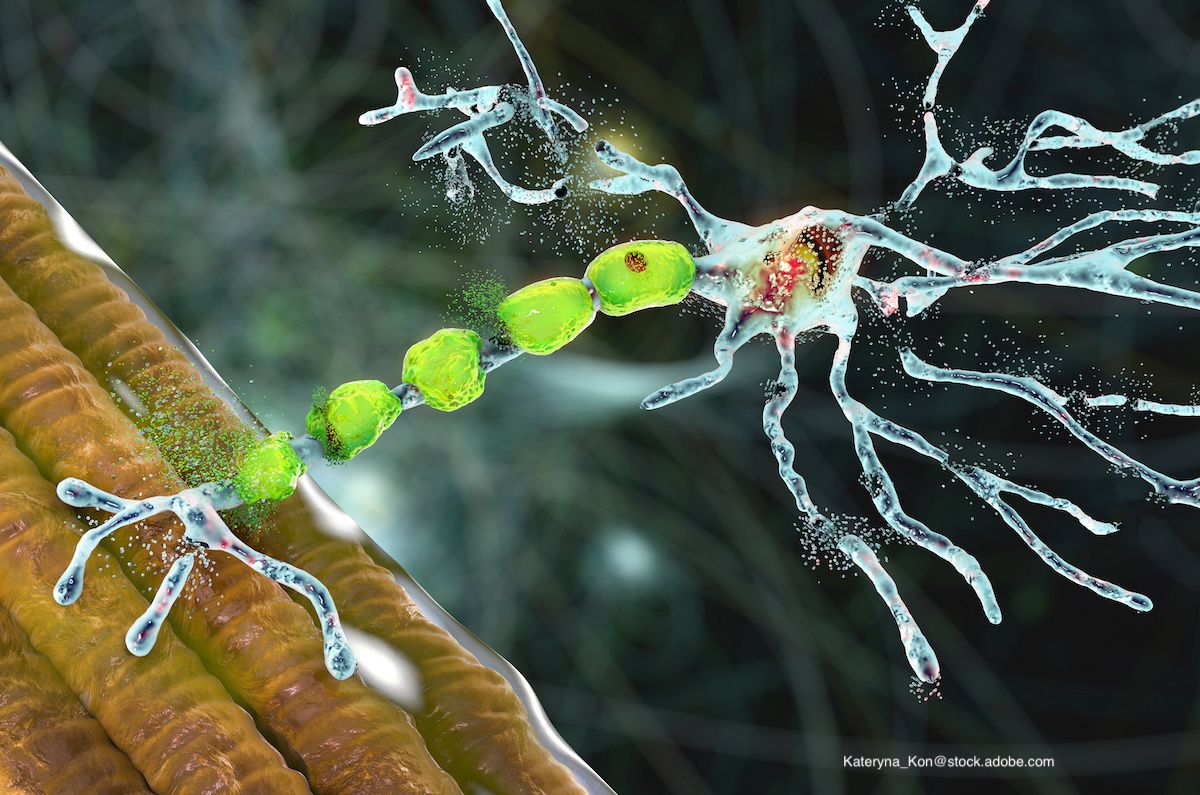 Relyvrio: A New FDA-Approved Treatment for Patients With ALS