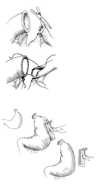 Principles of GI surgery (Proceedings) | dvm360