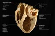 What Parts Of The Body Does Malignant Mesothelioma Affect