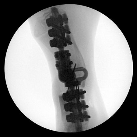 CSU uses distraction osteogenesis technique to help lengthen dog's leg ...