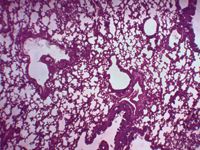 What's new in heartworm disease?