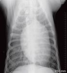 Canine blastomycosis: A review and update on diagnosis and treatment