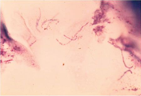 Overview of equine skin diseases