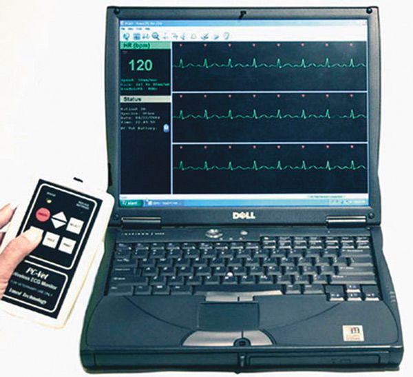 Wireless ECG