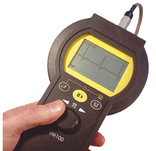 ECG Monitor