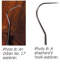 Dental probes and explorers-musts for examination