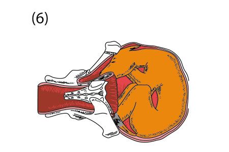 Dystocia in the mare: Manipulating a better outcome