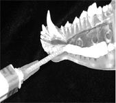 Mandibular fracture repair using acrylic external fixators (Proceedings ...