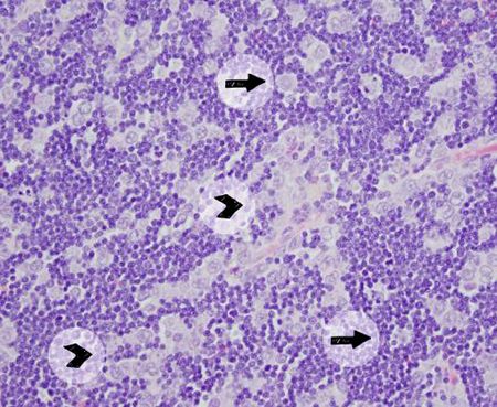 Thymoma in an 11-year-old dog: Anatomic pathology perspective