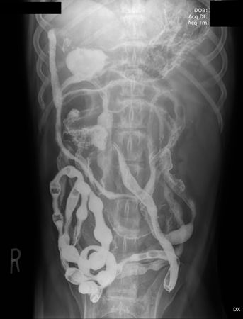 Skills Laboratory: How to perform a positive contrast gastrointestinal ...