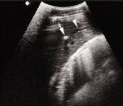 Liver disease in the horse: diagnostic aids and differential diagnosis ...