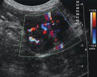 How to ultrasound and evaluate the thyroid and parathyroid glands | dvm360