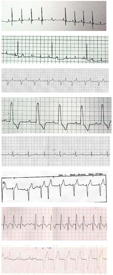 ECG case studies (Proceedings)