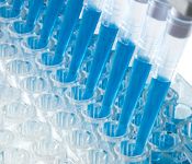 IDEXX introduces Spec cPL for detecting canine pancreatitis | dvm360