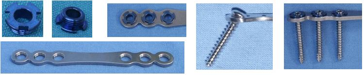 Locking plates: What's the difference? (Proceedings)