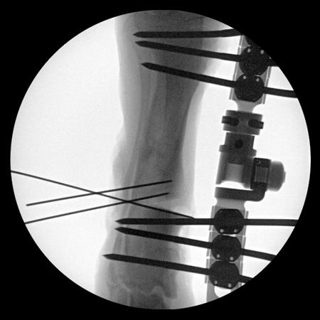 Photo gallery: Novel veterinary surgical technique helps lengthen dog's leg