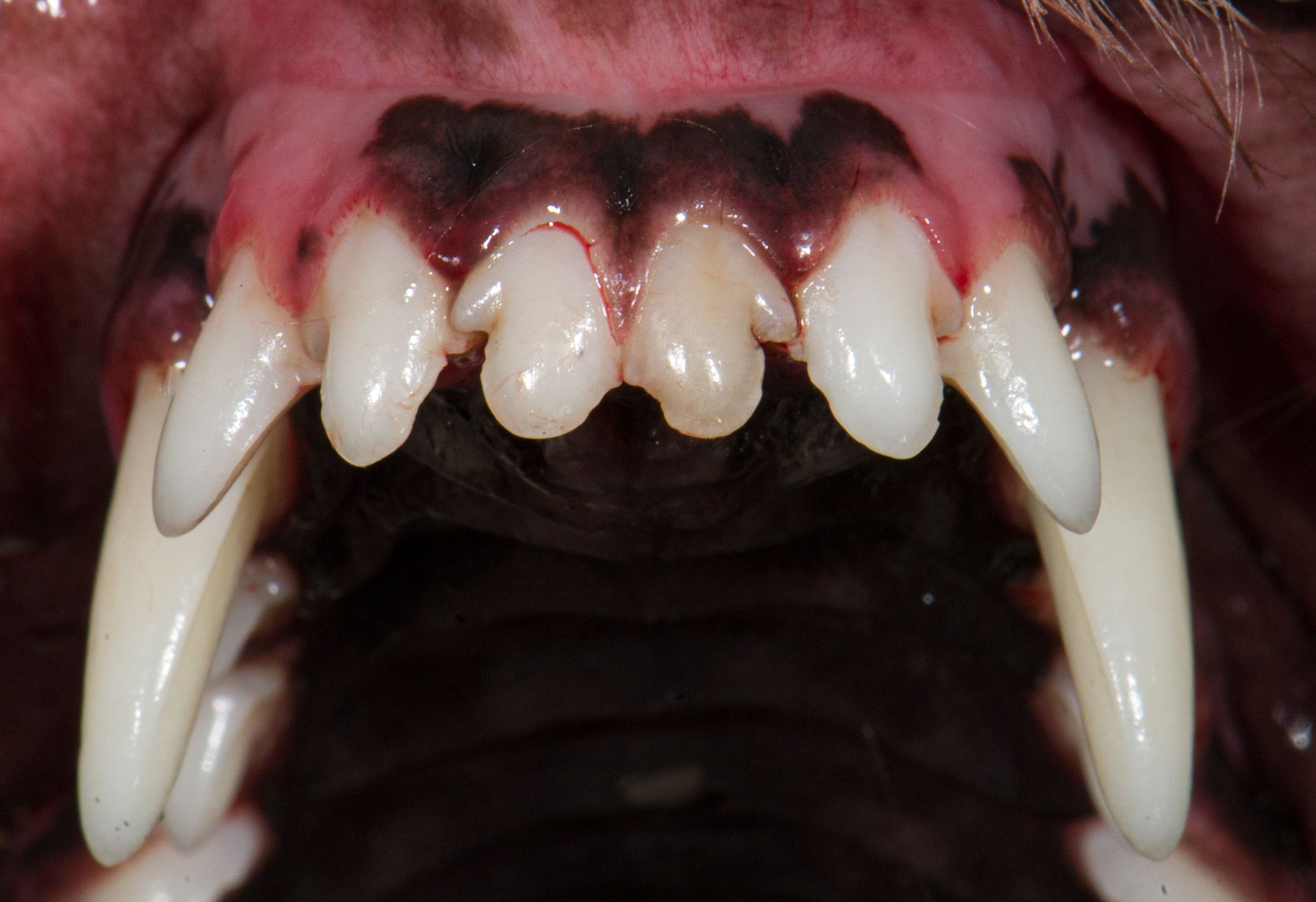 F is for fractured teeth