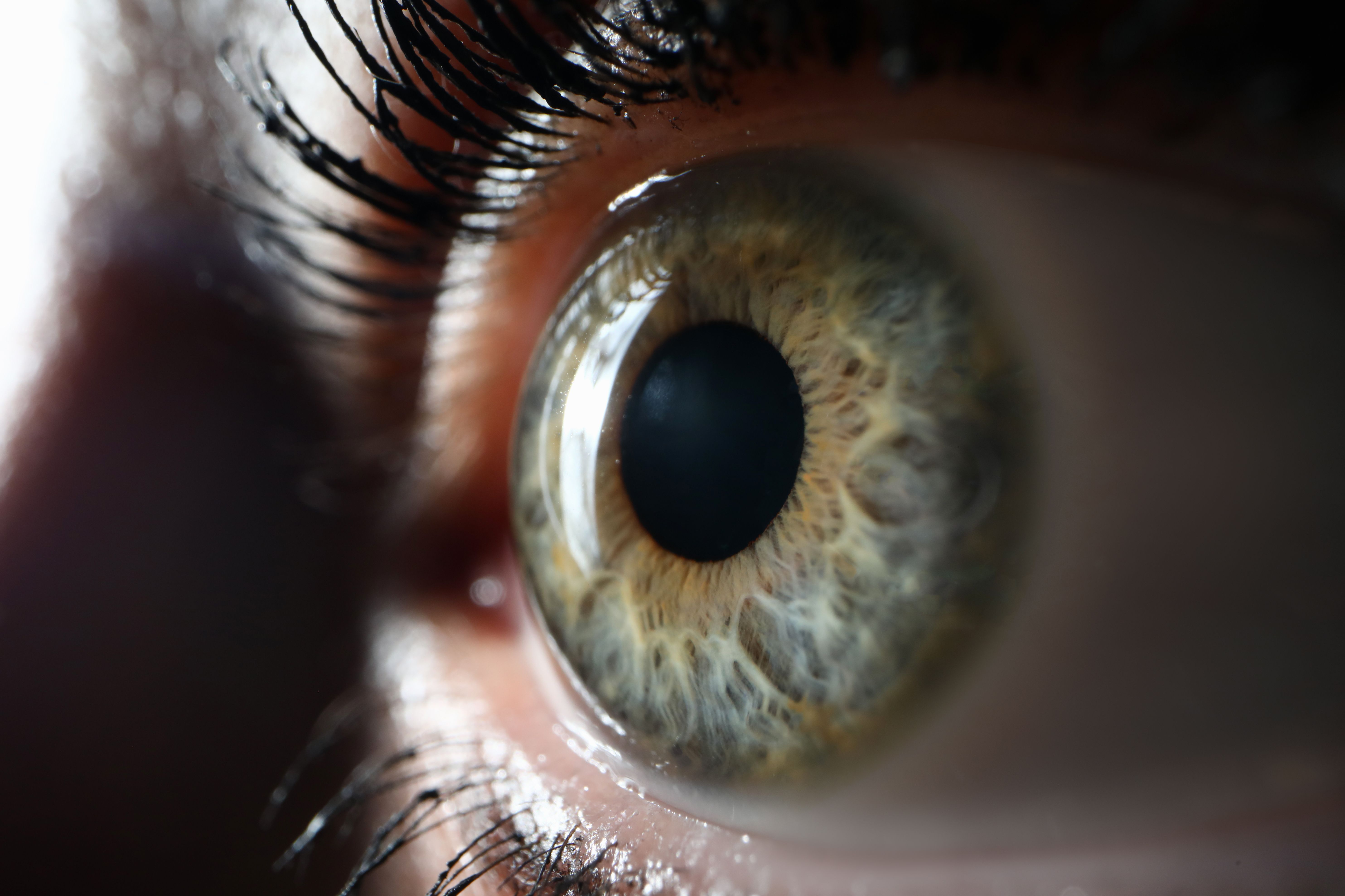 Leber Congenital Amaurosis 2 Gene Therapy Trial Doses First Patient