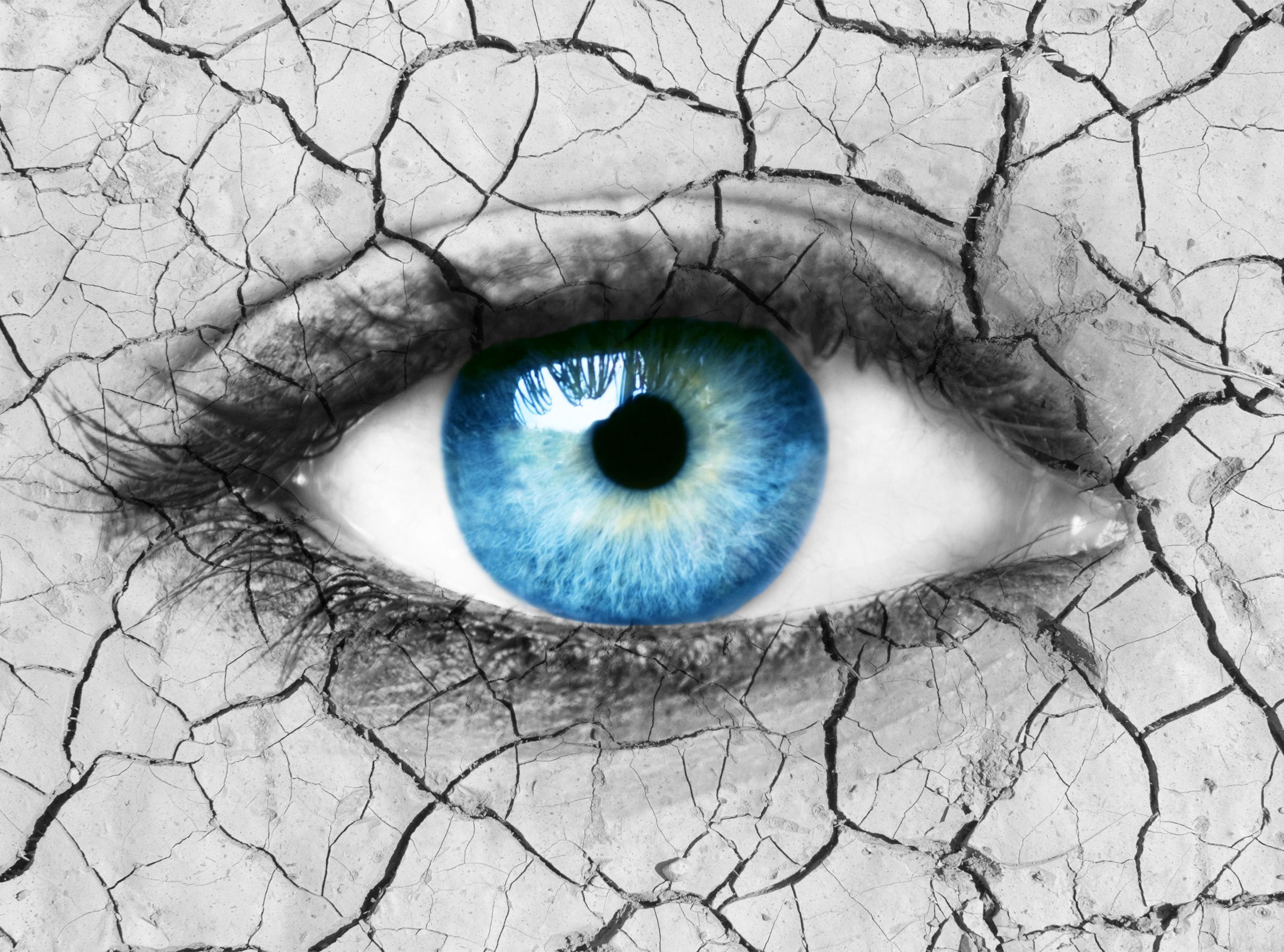 Stem Cell-Derived Eye Drops Improve Outcomes in Dry Eye Disease