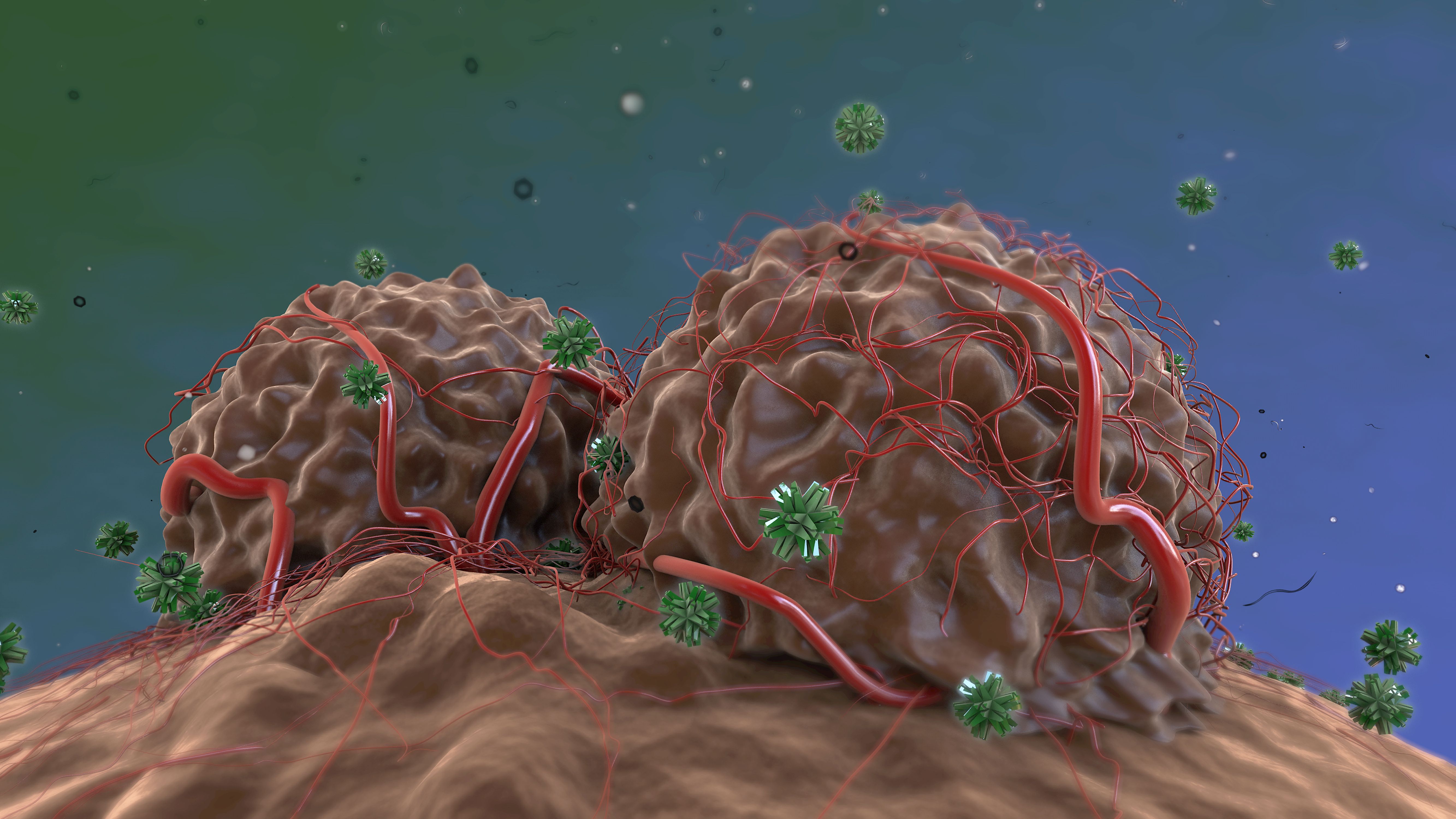 Tmod CAR T-Cell Therapy Offers Precise Targeting of Solid Tumors