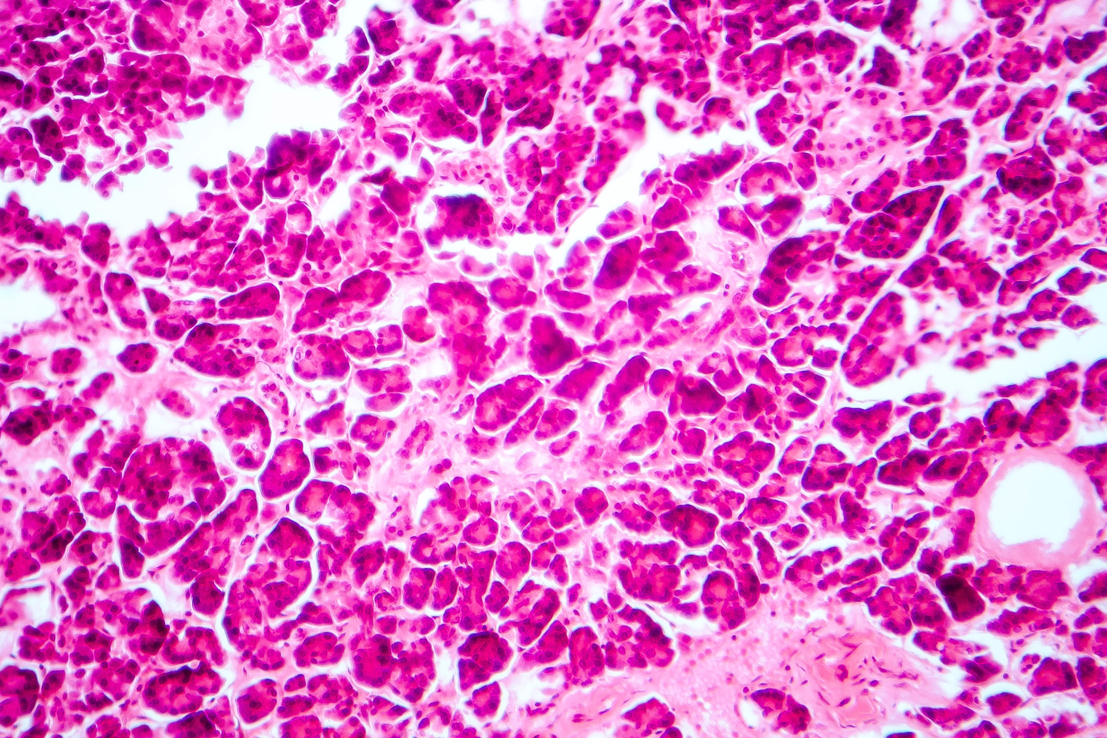 Patients With Type 1 Diabetes Independence Achieve Insulin Independence ...