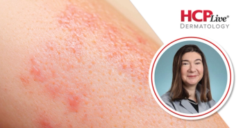 FDA Approves Acoramidis (Attruby) for ATTR-CM | HCPLive