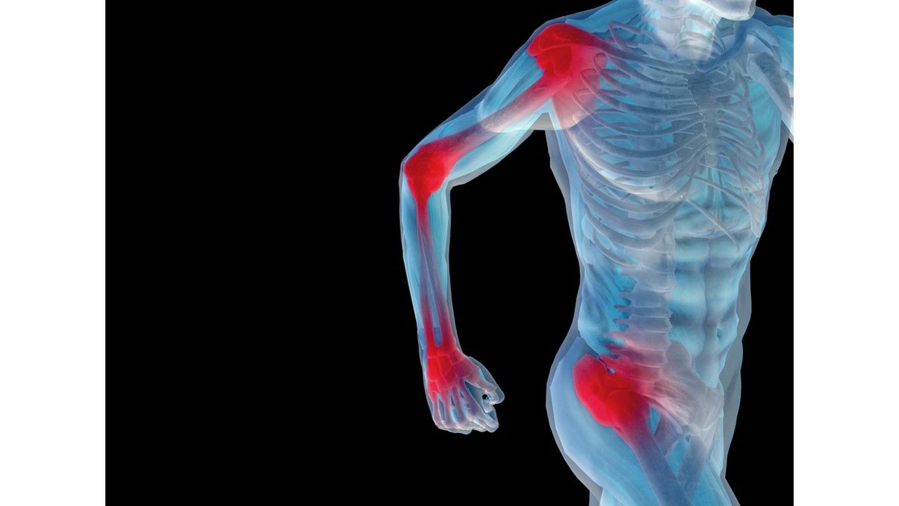 EULAR/ACR Treatment Guidelines for Polymyalgia Rheumatica