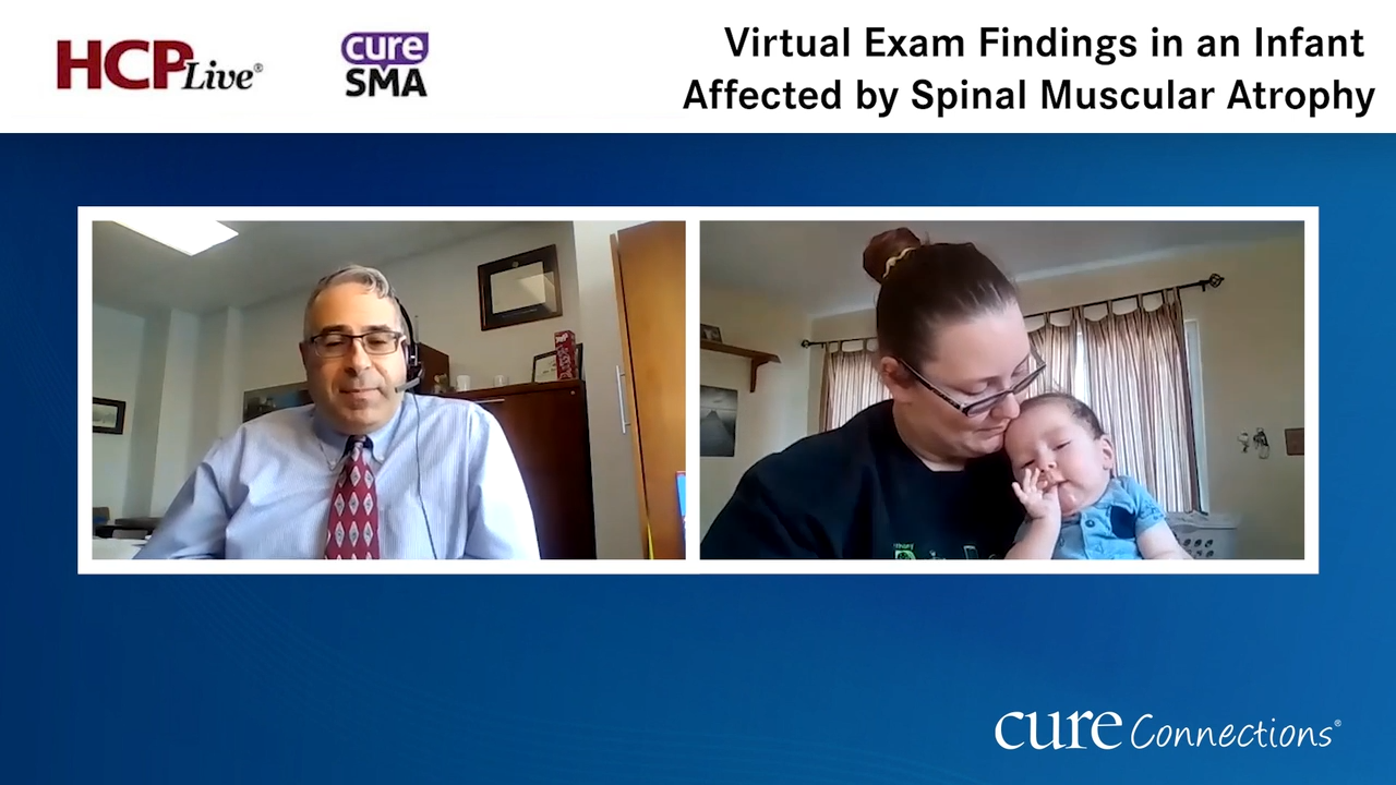 Virtual Exam Findings in an Infant Affected by Spinal Muscular Atrophy