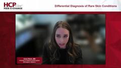 Use of Biologics in Rare Dermatologic Disorders | HCPLive