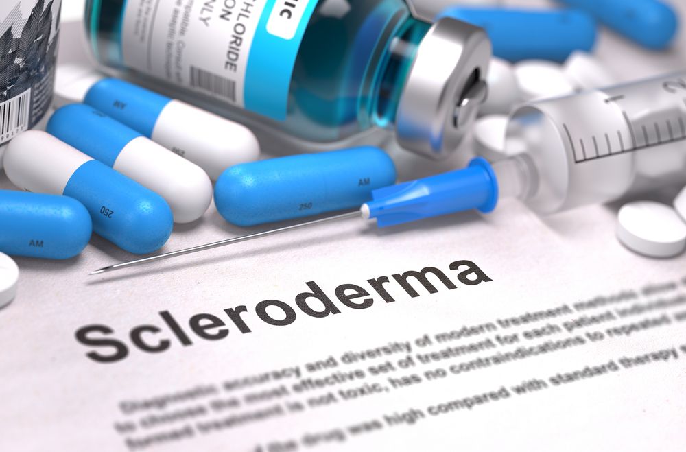 Case Study: Scleroderma sin Scleroderma