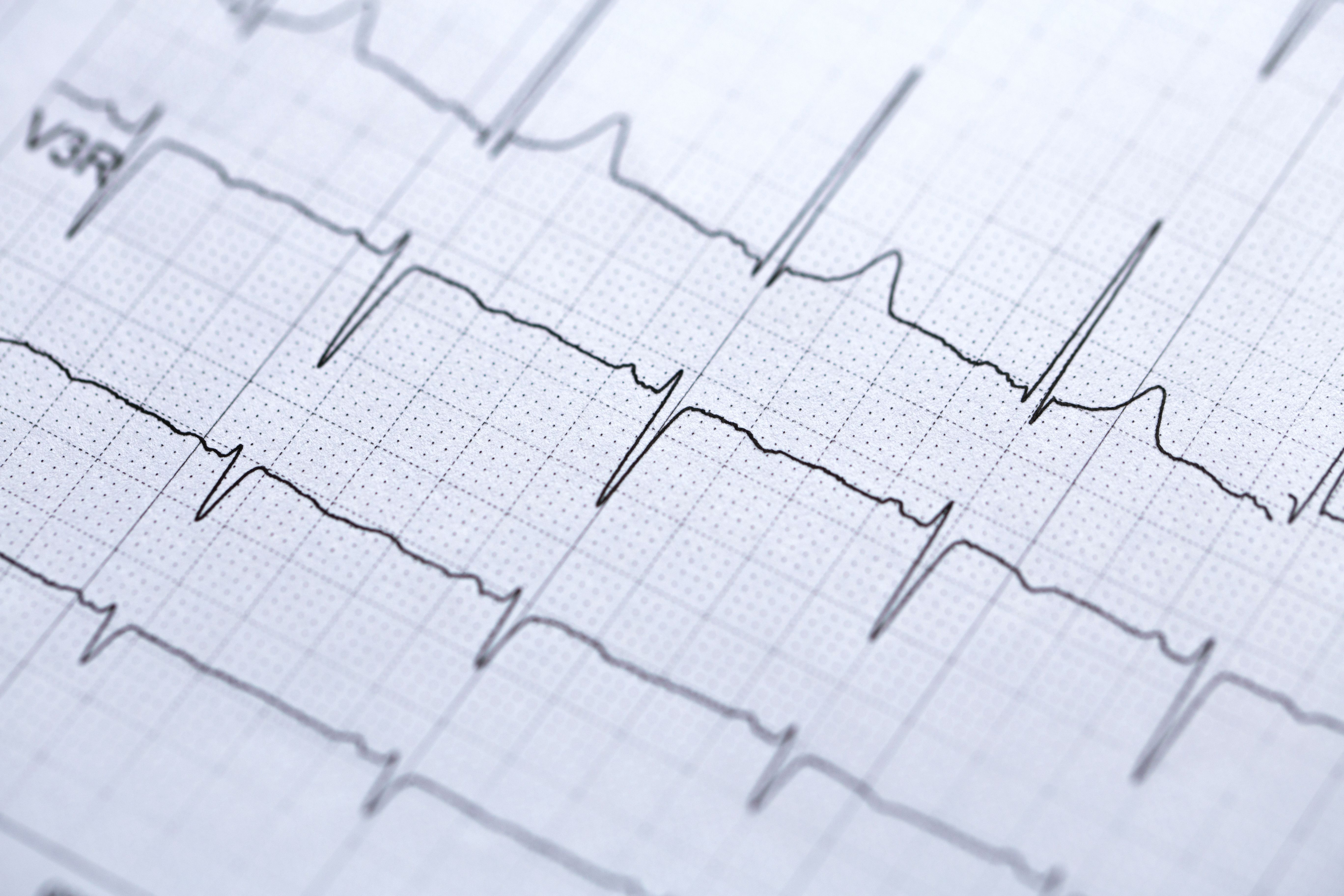 Gregory Weiss, MD: Guidelines on Quality Measures for AFib | HCPLive