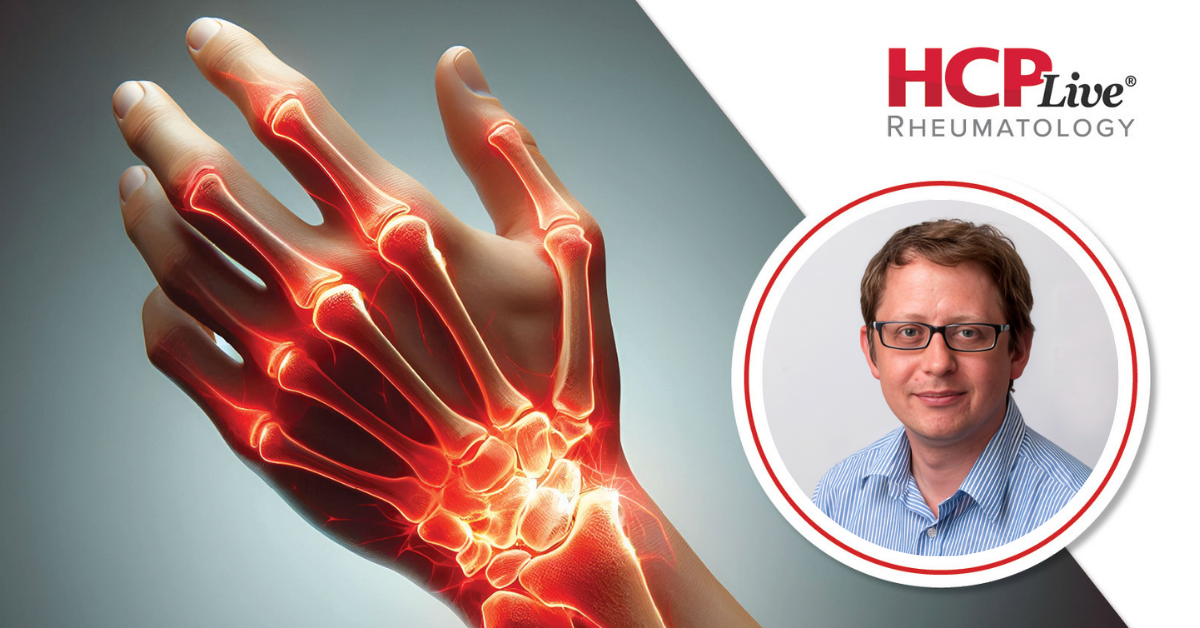 What’s Next for Dapirolizumab Pegol Following Lupus Phase 3 Trial, With ...