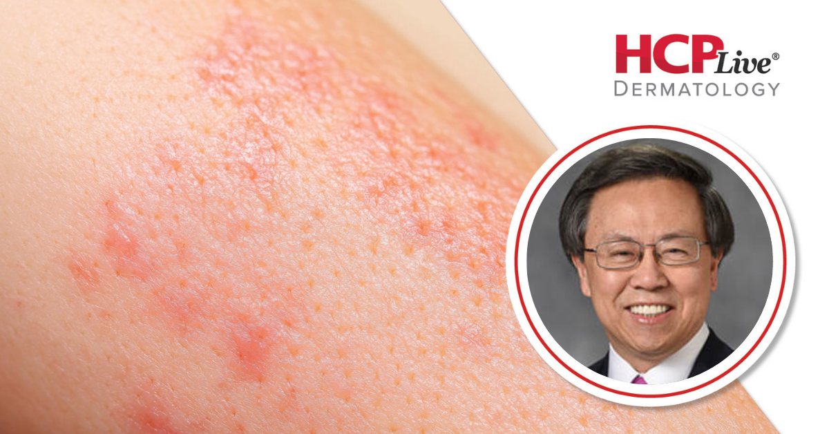 Expert Consensus on Knowledge Gaps in Dermatology for Skin of Color ...