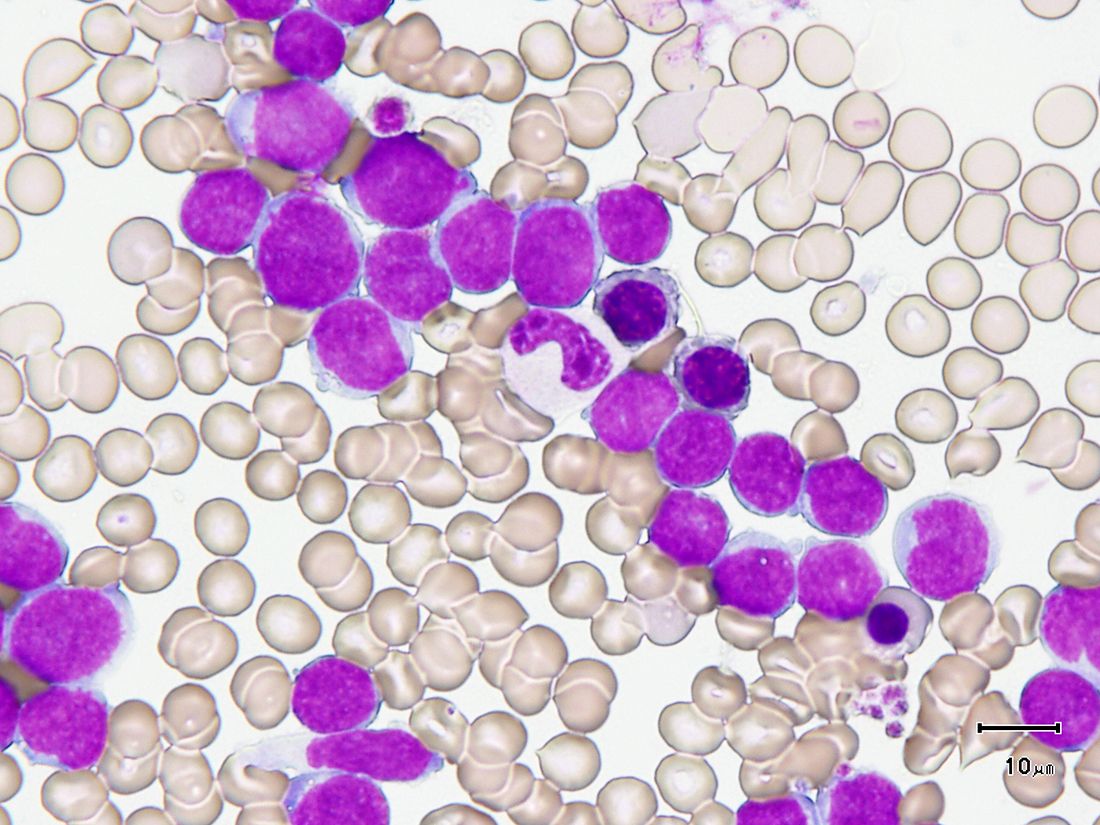 Phase 1 Trial of Ivosidenib for Patients with AML Boasts Positive Results
